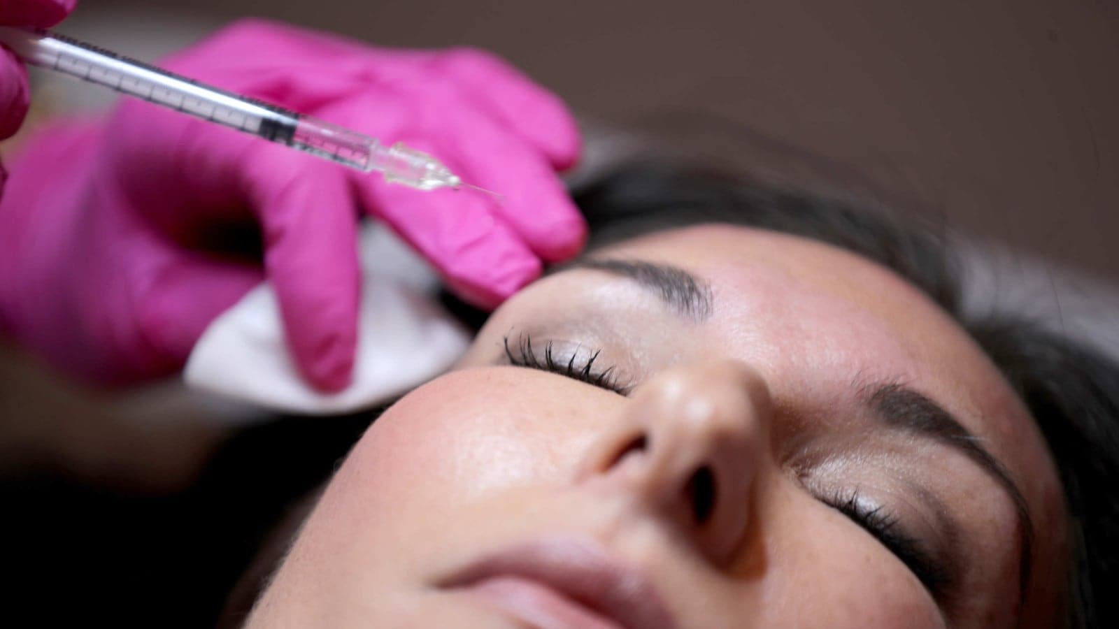 Baby Botox – Die sanfte Alternative der Faltenbehandlung