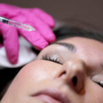 Botox Stirn | Stirnfalten glätten mit Botulinumtoxin